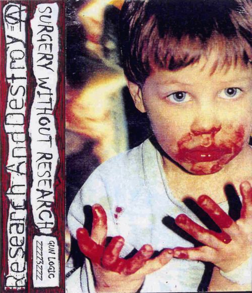 Surgery Without Research Albums: songs, discography, biography, and ...