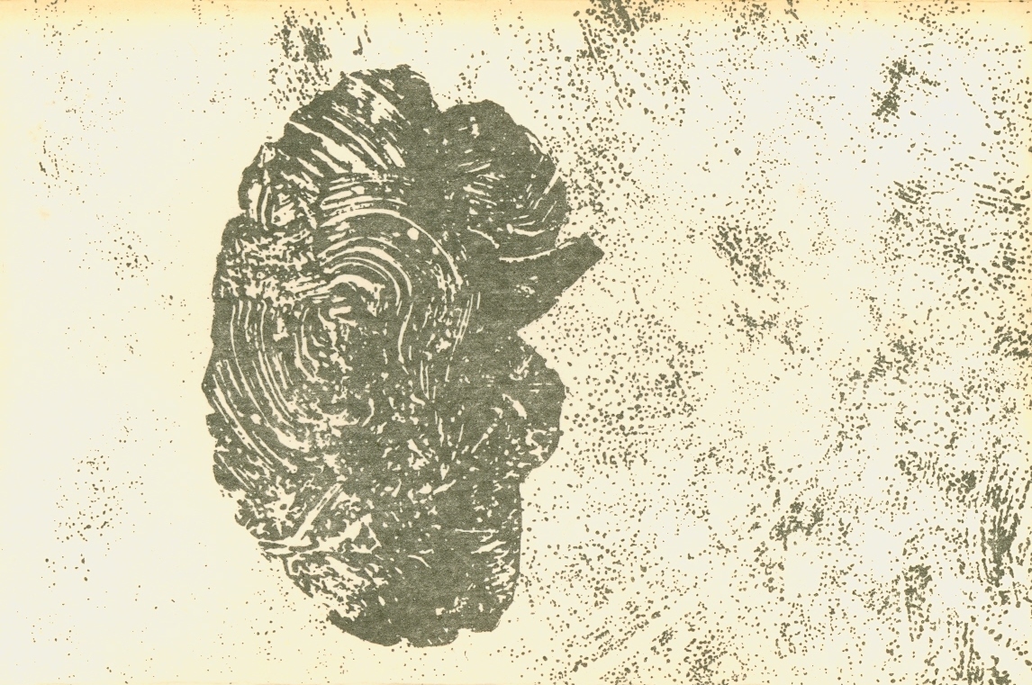 Alien Brains Albums: songs, discography, biography, and listening guide ...