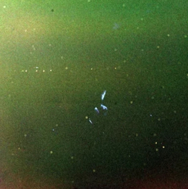 Teeth/Enigma by Sunshine (Single): Reviews, Ratings, Credits, Song list ...