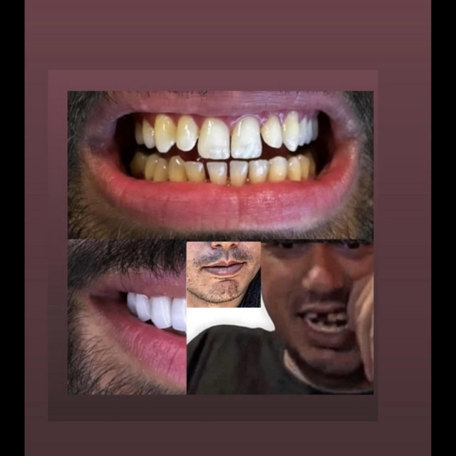 Caca Man by French Fries (Single): Reviews, Ratings, Credits, Song list ...