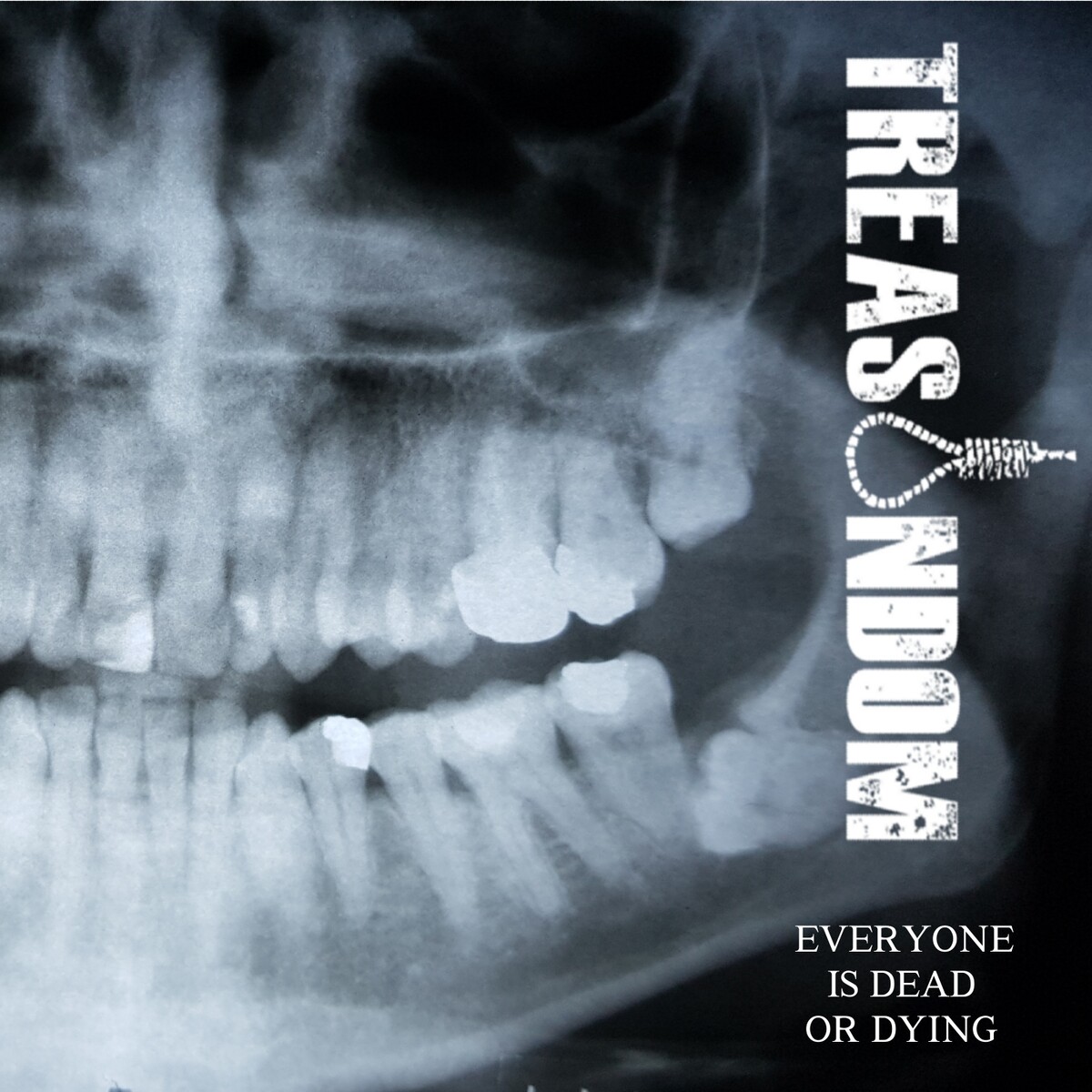 Everyone Is Dead or Dying by Treasondom (Single): Reviews, Ratings ...