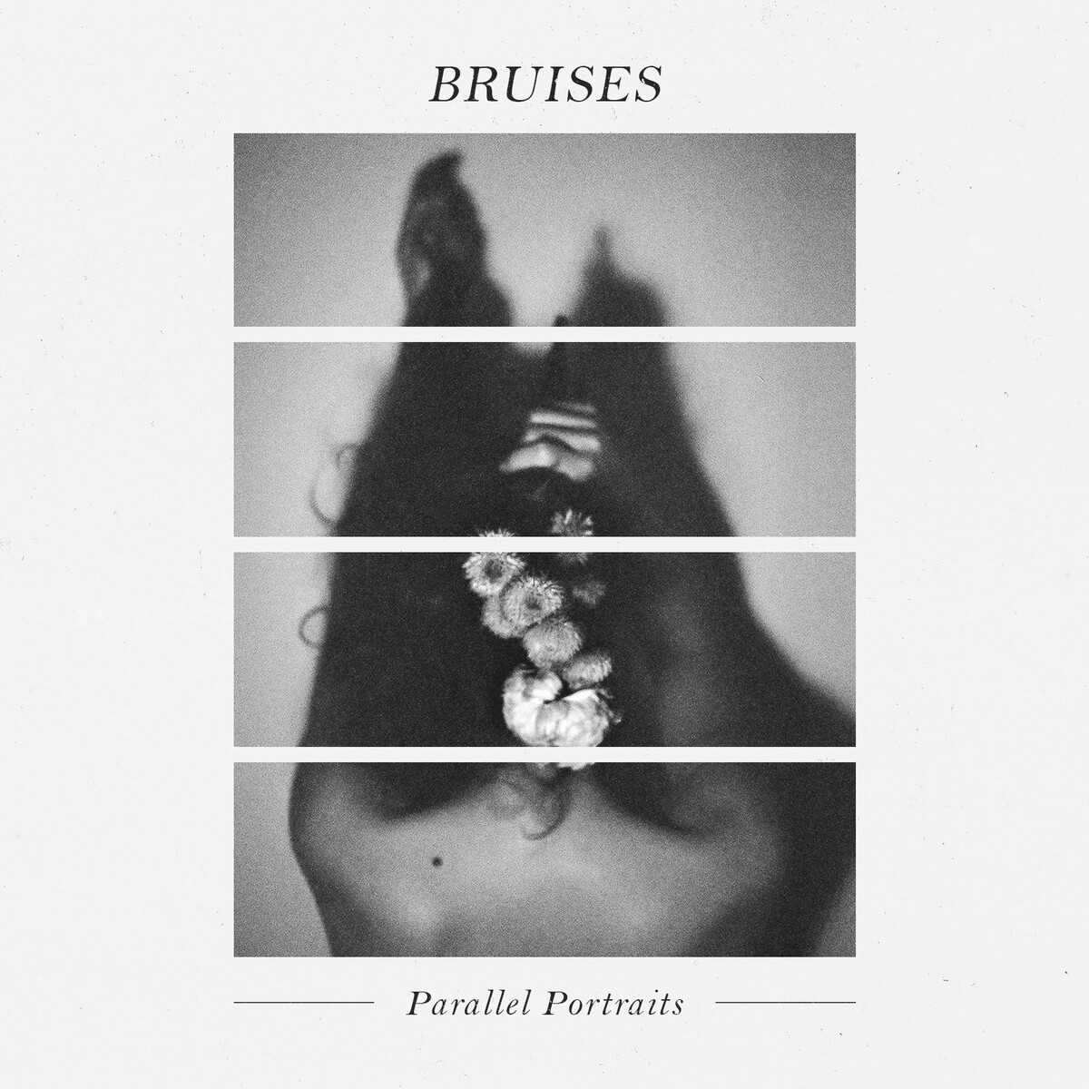 Bruises Albums: songs, discography, biography, and listening guide ...