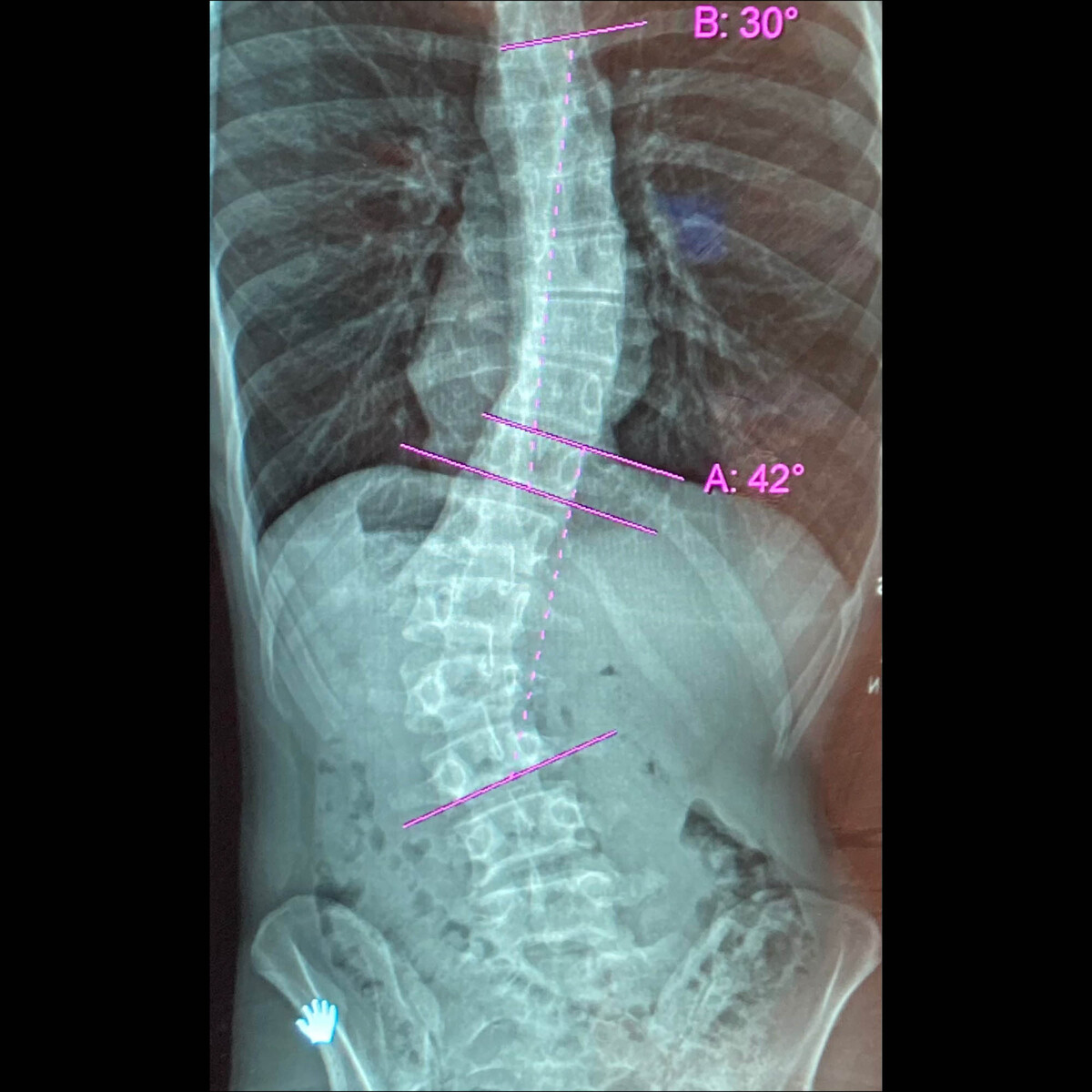 crying chiyo Albums: songs, discography, biography, and listening guide ...