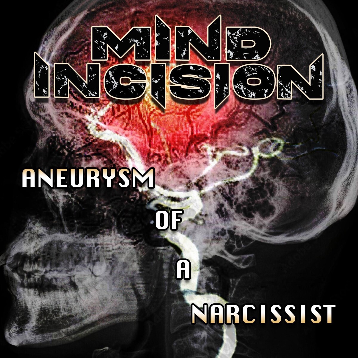 Aneurysm of a Narcissist by Mind Incision (Single): Reviews, Ratings ...