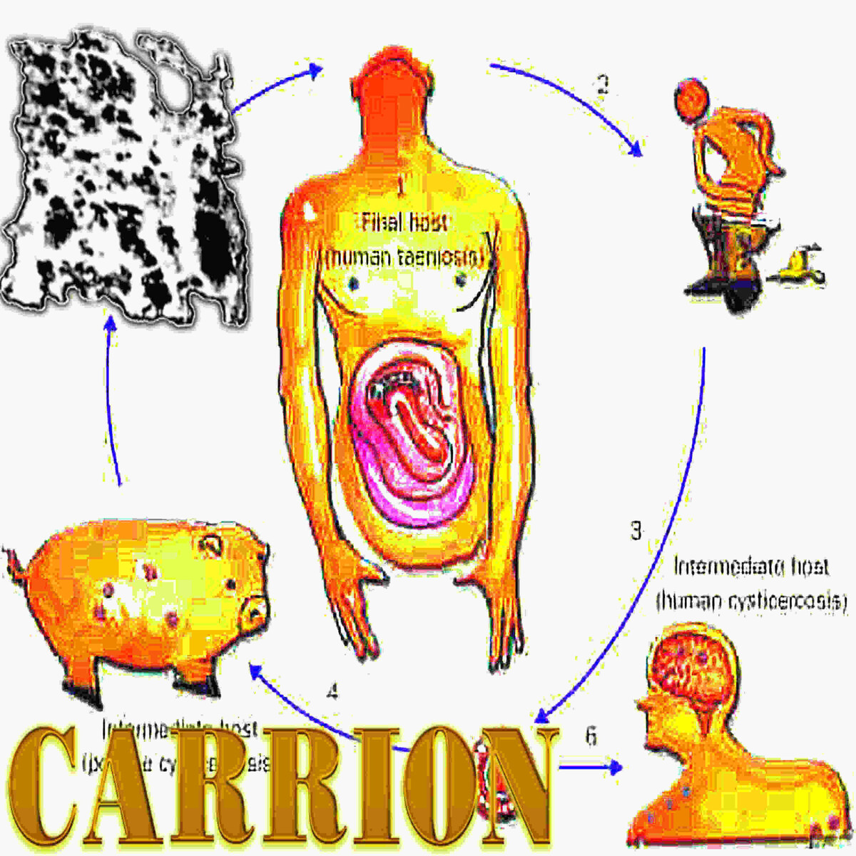 Carrion by AxExHxCx (Single): Reviews, Ratings, Credits, Song list ...