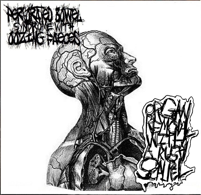 Organ Removal With a Rusty Scalpel Albums: songs, discography ...