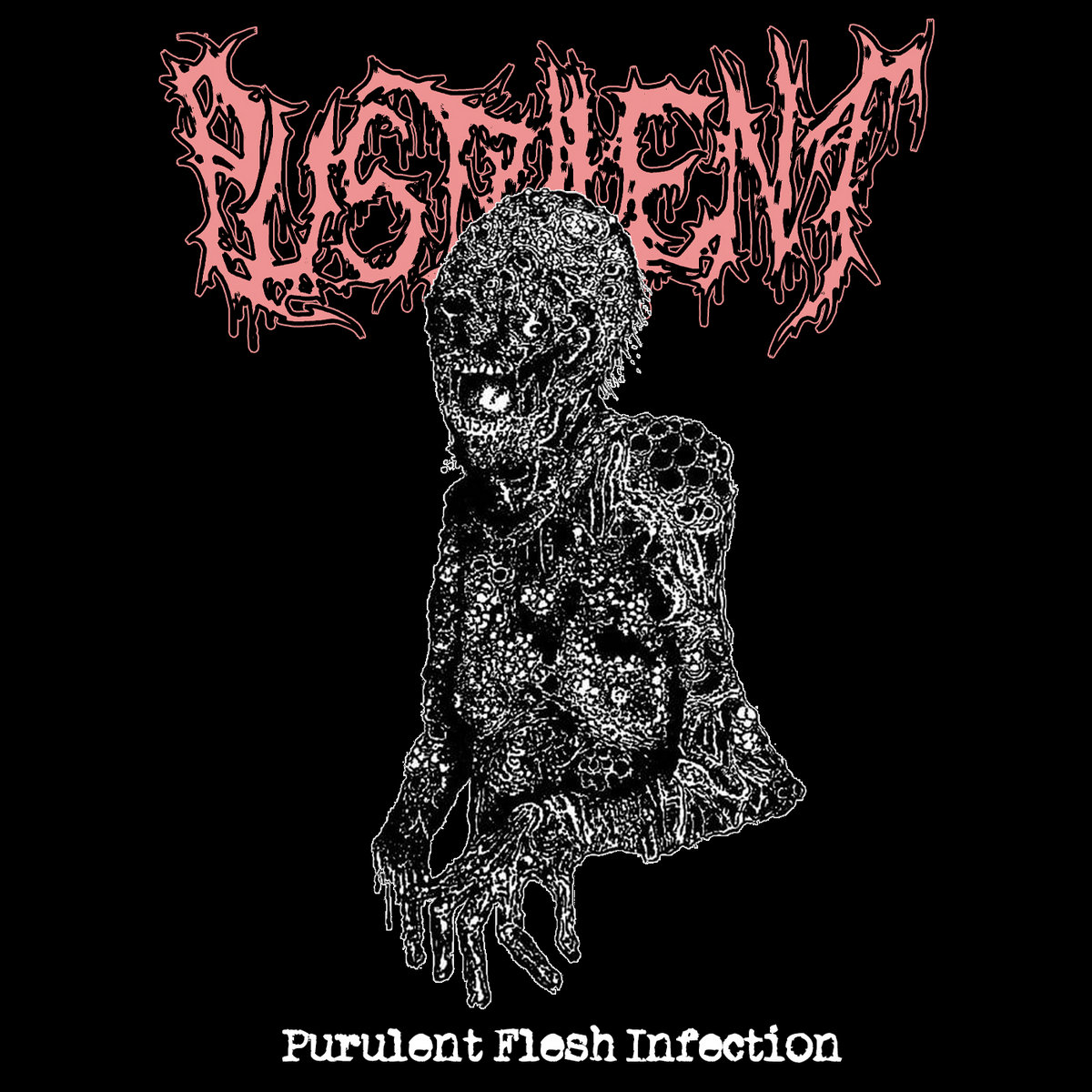 Pustulent Albums: songs, discography, biography, and listening guide ...