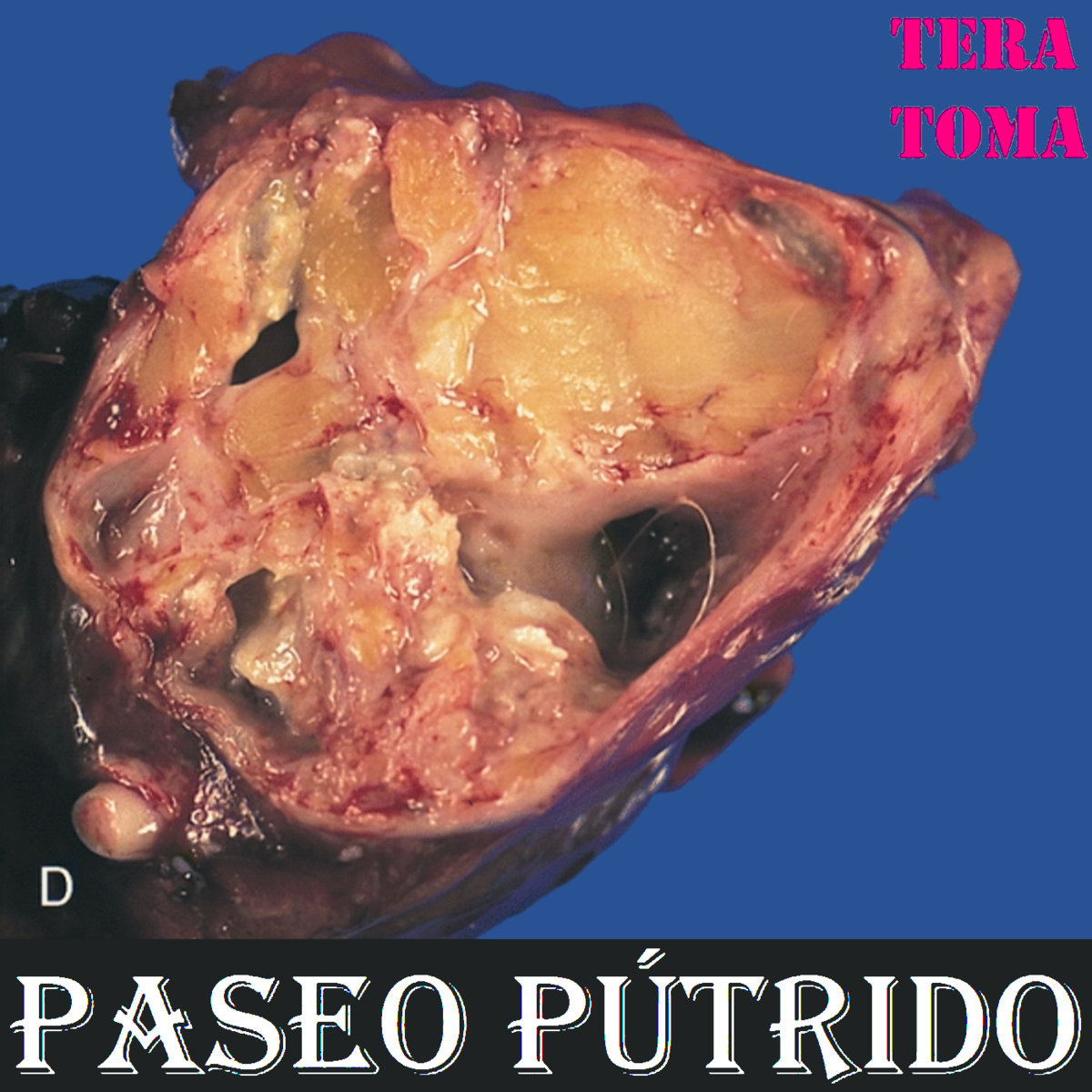 Paseo pútrido by t3r4t0m4 (EP): Reviews, Ratings, Credits, Song list ...