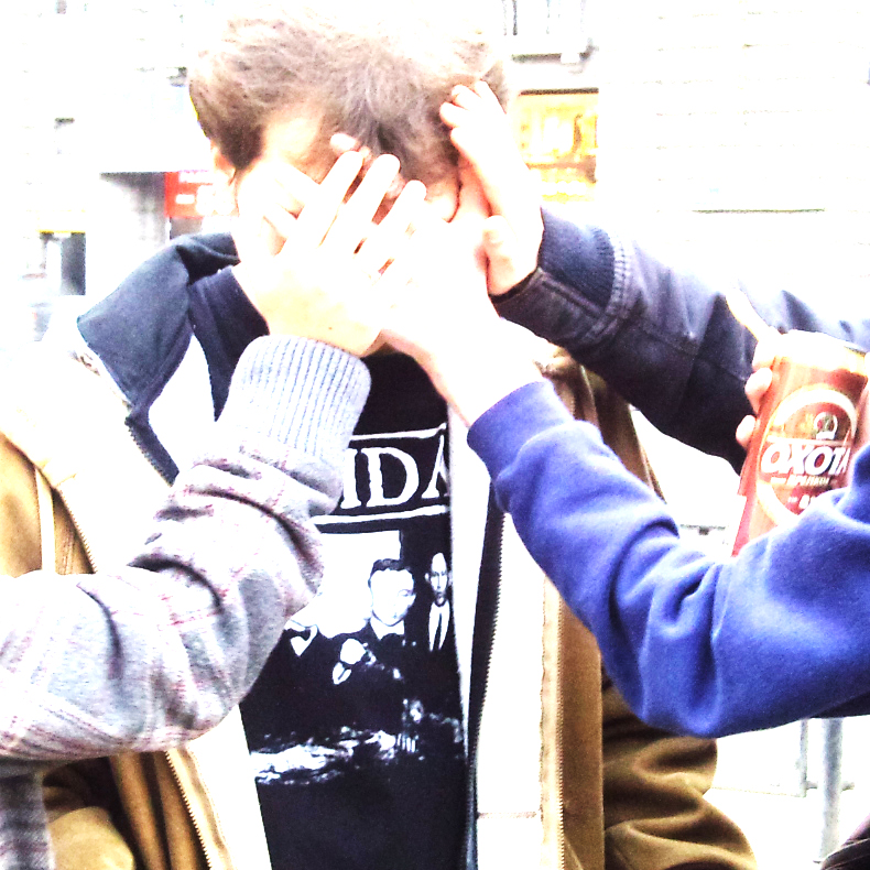 Acute Enterorrhagia Due to Appendiceal Mucosal Erosion by ...