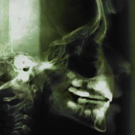 Apulanta Albums: songs, discography, biography, and listening guide ...