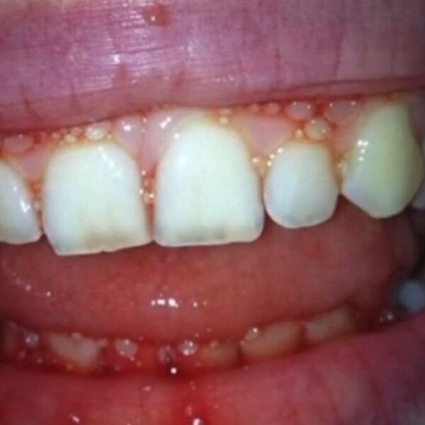 FUCKSHITUP (OLD SCHOOL EXTREME TERRORCORE GABBER) by Crisis Hotline ...