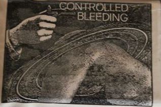 Welcome in the Psychic Torture by Controlled Bleeding (Album): Reviews, Ratings, Credits, Song ...