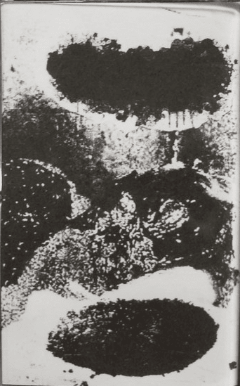 Blenncardichromodacryexgenitohaemgene / Stercoraceous Copremesis ...