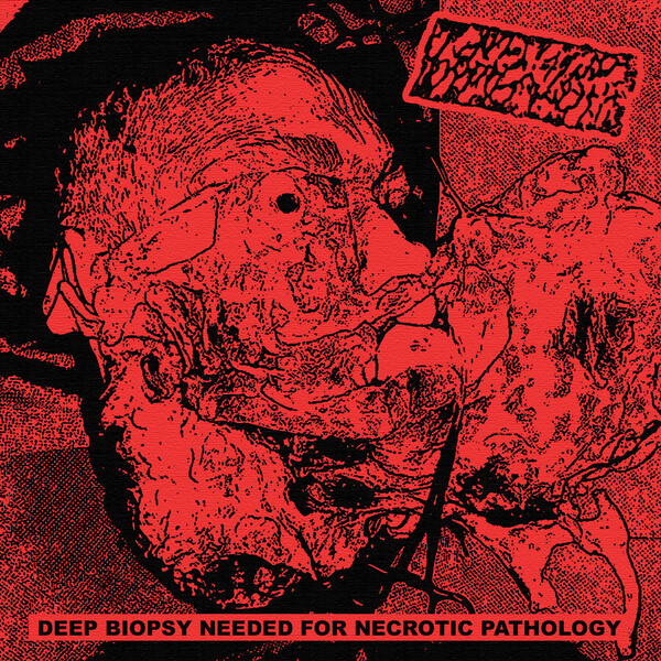 Deep Biopsy Needed for Necrotic Pathology by Histologist (Album ...