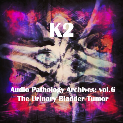 The Urinary Bladder Tumor: Audio Pathology Archives Vol. 6 by K2 (Album; Kinky Musik Institute ...